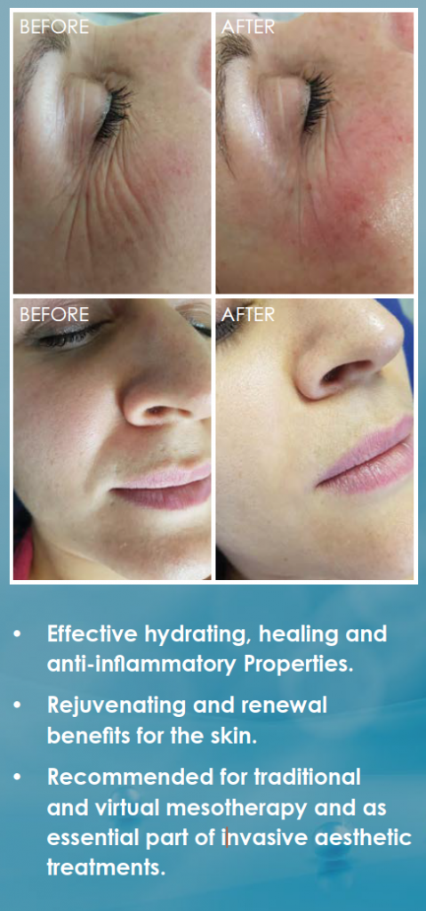 Essel Products: New Vectorized Hyaluronic Acid For Aesthetic ...