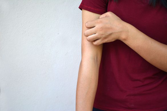 Dupixent® (Dupilumab) Now Available In South Africa For Treatment Of ...