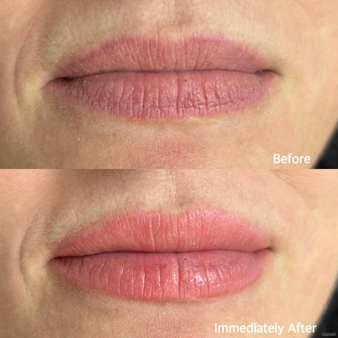 Sandton Aesthetic Institute: Complete Skin Reboot 2024