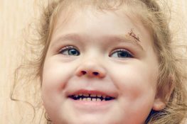 Toddler Scars: A Parent's Guide To Childhood Scarring | Aesthetic ...