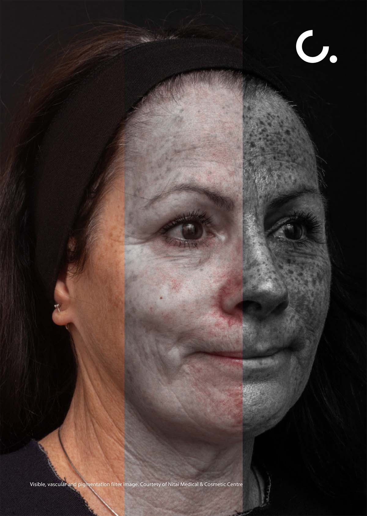 Standardised Clinical Photography: Why The Clinical Imaging System Was ...