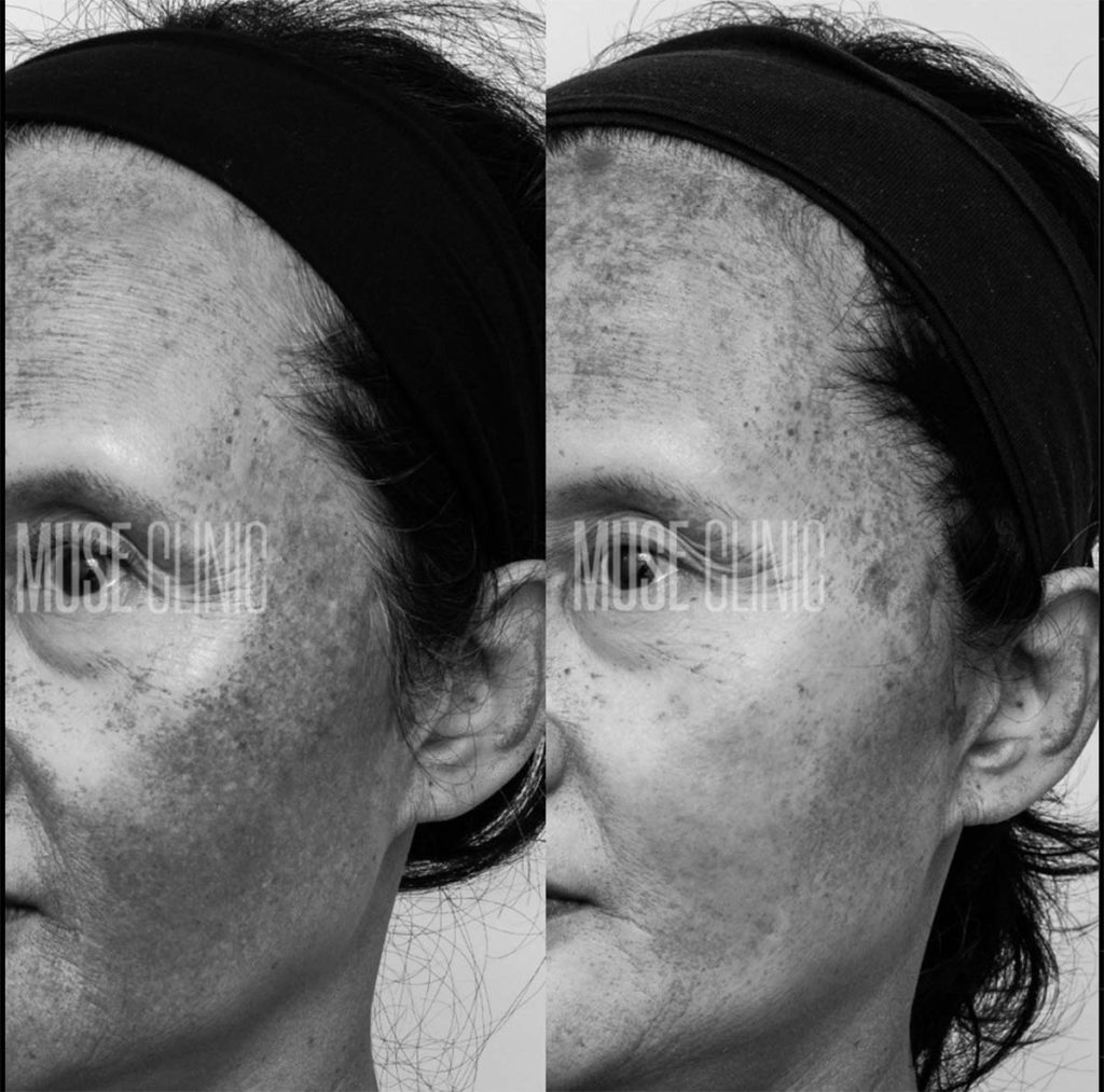 Standardised Clinical Photography: Why The Clinical Imaging System Was ...