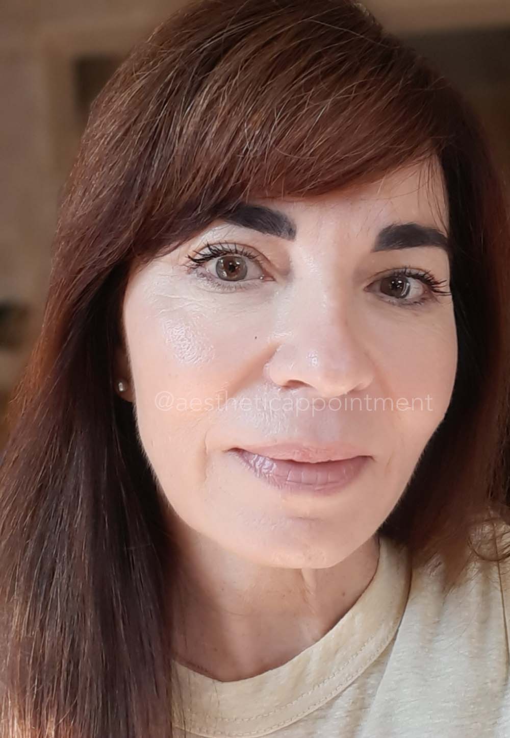 Review: The Intraceuticals Oxygen Facial – Rejuvenate Without The ...