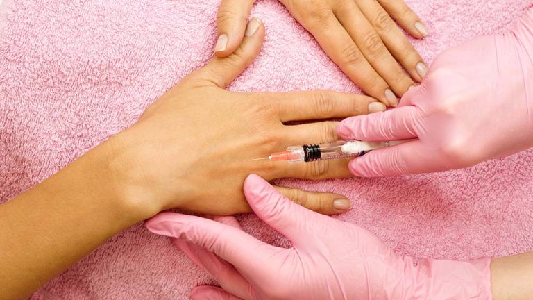 The Art Of Hand Rejuvenation: A Holistic Approach | Aesthetic ...