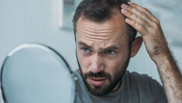 Exploring The Common Causes Of Hair Thinning And Loss In Both Men And ...