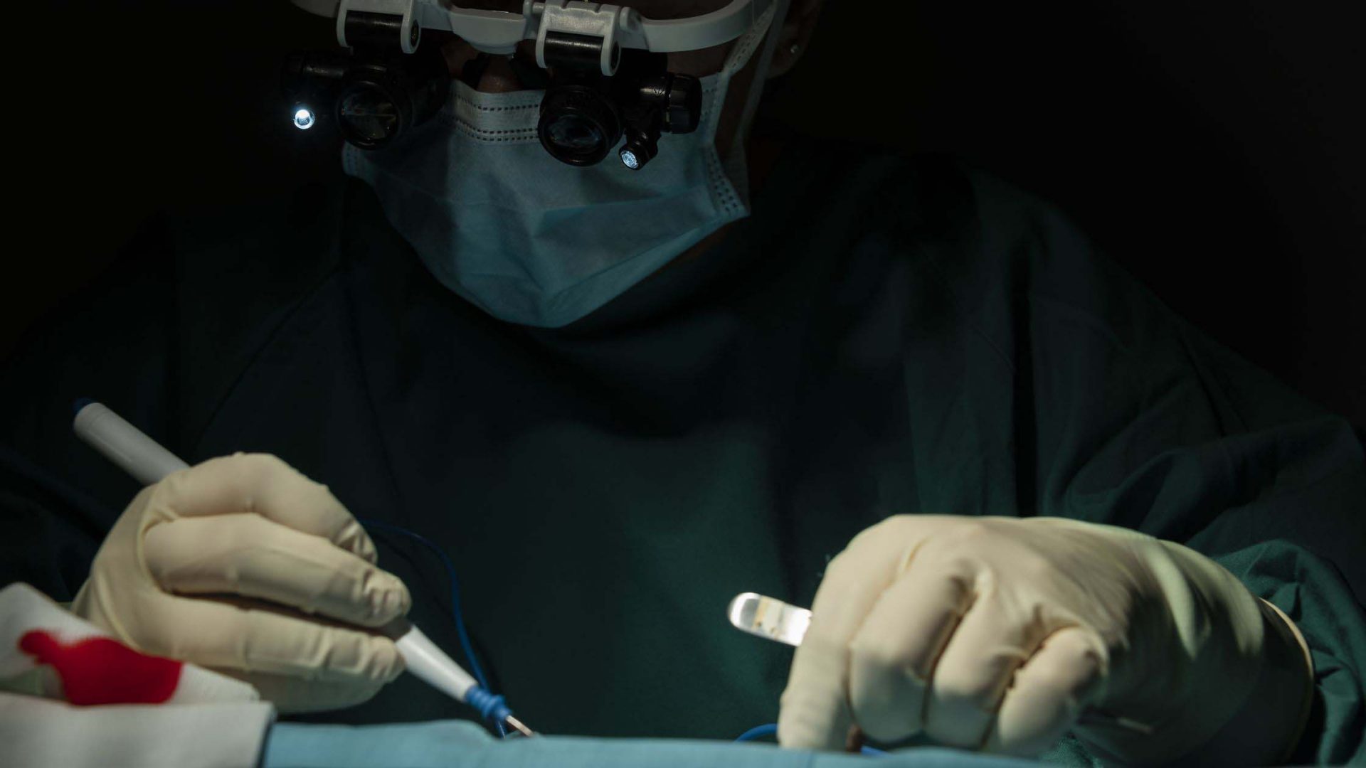 Regenerative Medicine And Lymphoedema: Exploring The Possibilities ...